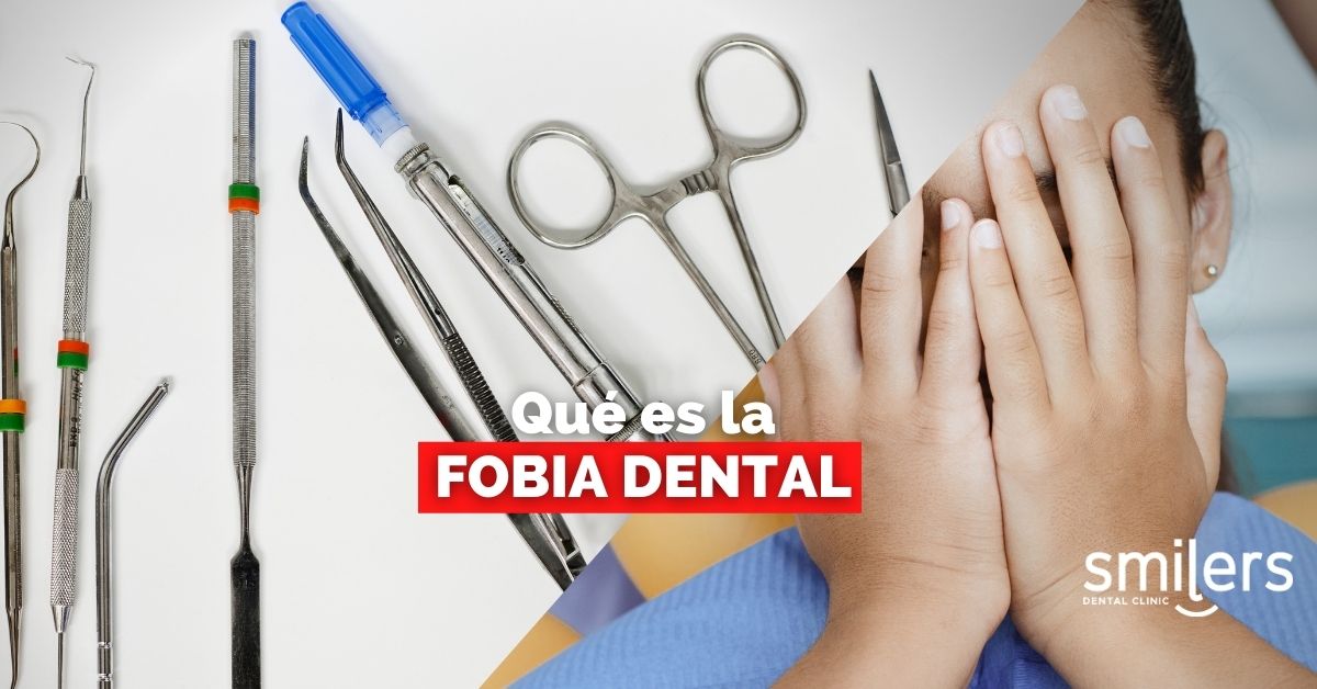 What is Dental Phobia or Odontophobia and How to Avoid It?