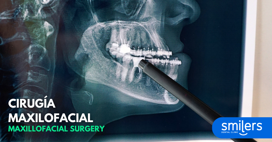 What is Maxillofacial Surgery? Everything You Need to Know