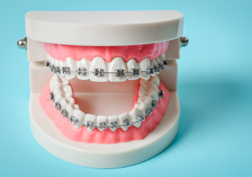 Dentistas Mexicali | Smilers clínica dental en Mexicali